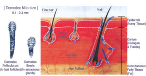 Demodex Described | The Dry Eye Treatment Center